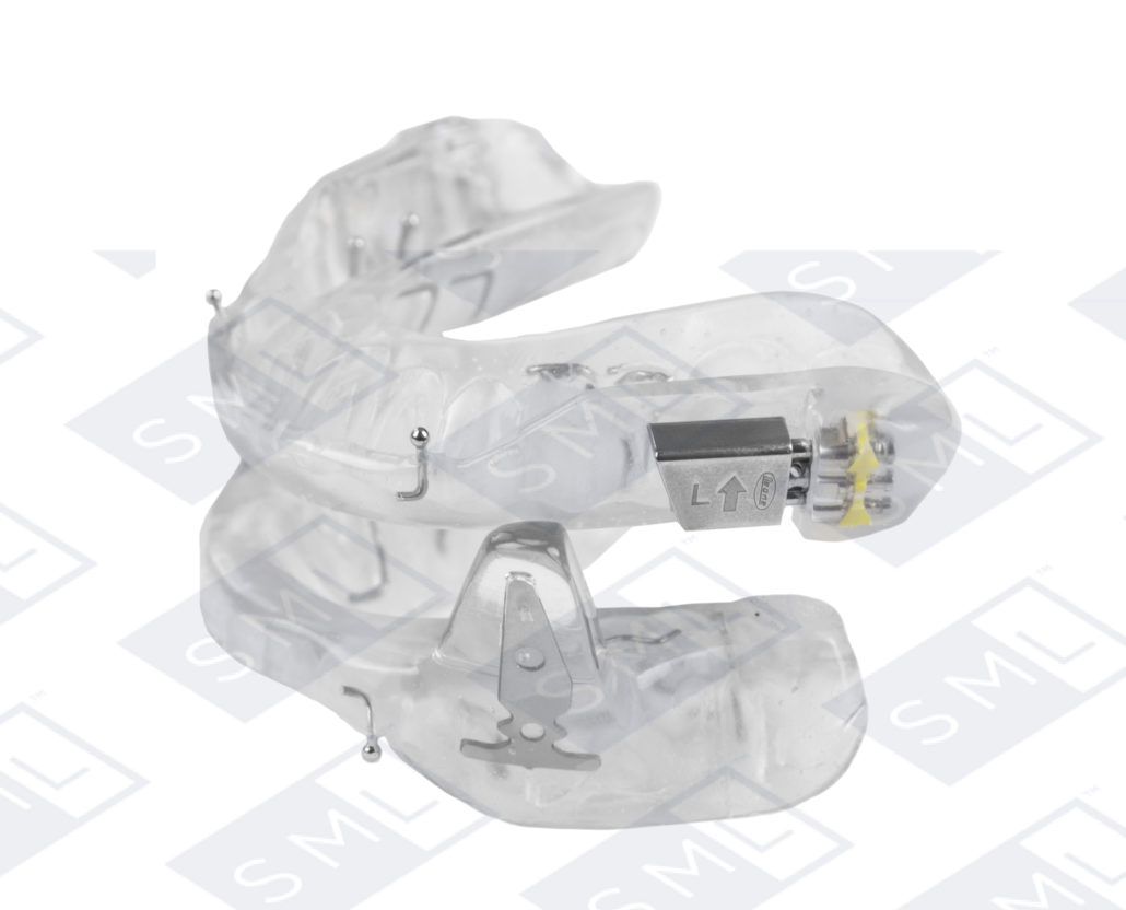 Treatments – Snore No More and Sleep Solutions – Drs. David Jin and ...